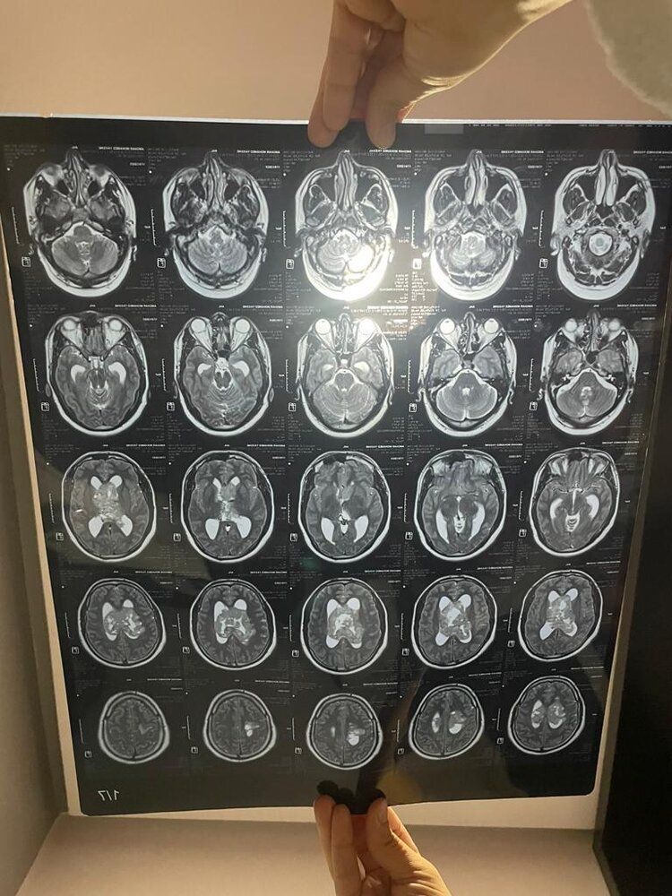 Hjelp en far med operasjon av tumor/ hjernesvulst | Spleis fra SpareBank 1