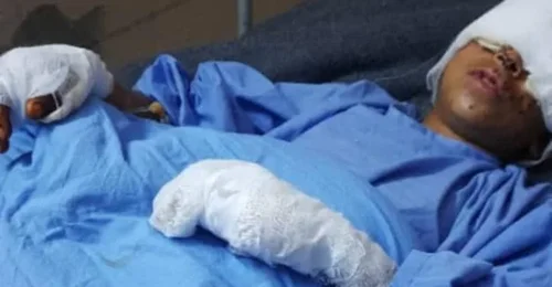 Valid trenger hjelp | Spleis fra SpareBank 1